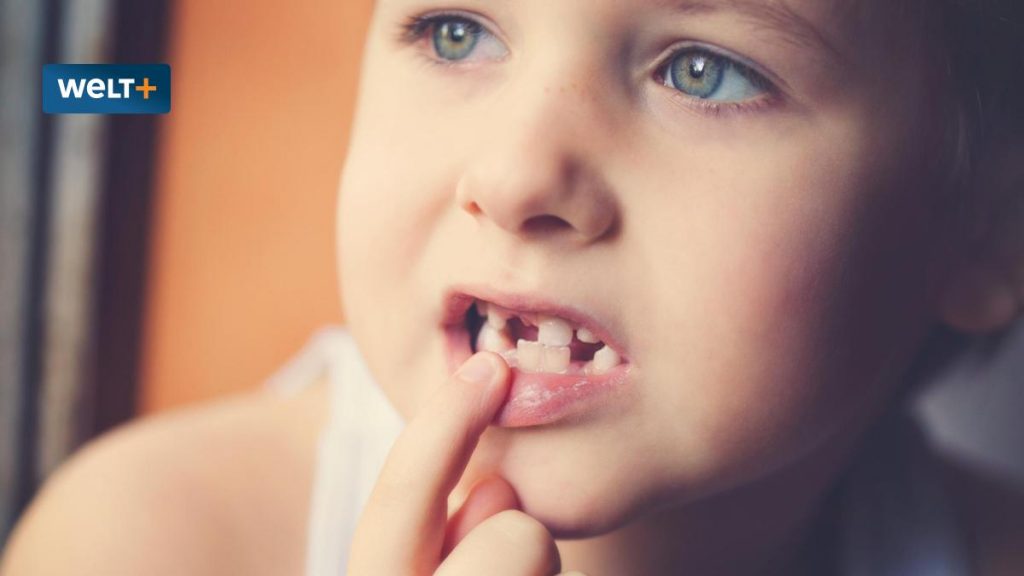 Chalk teeth: When children's teeth to discolor and crumble - Law ...